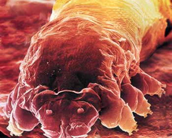 Demodex folliculorum | eOtazky.sk